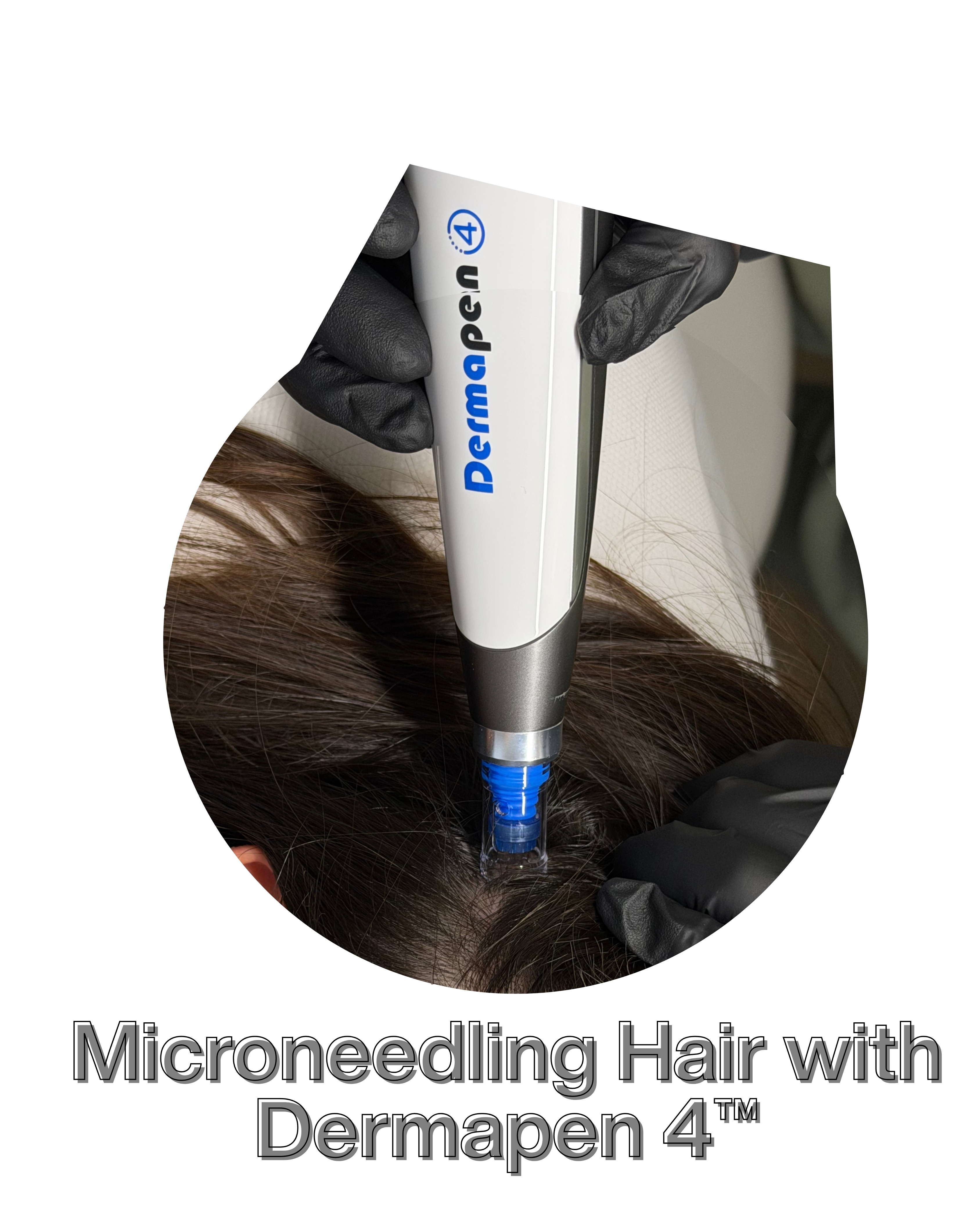 Microneedling Hair with Dermapen 4™ (for Scalp) | NeoXell Beauty Clinic